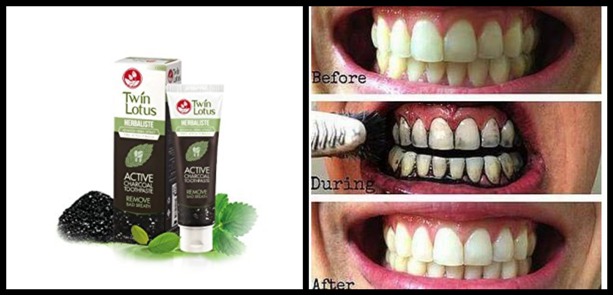 15 Best Charcoal Toothpaste for Teeth Whitening